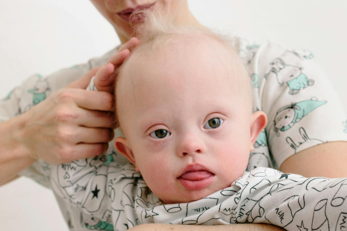 Otkrivanje Downovog sindroma prije rođenja: Koliko su pouzdani genetski ...